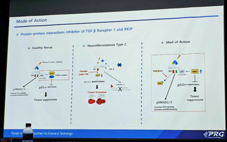 ‘PRGS&T enters clinical trials for type 2 fibromatosis > NEWS MEDIA | 피알지에스앤텍